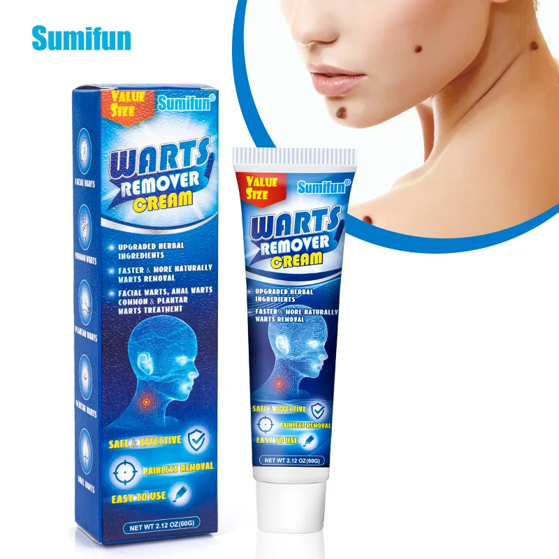 Genital Warts Removal Cream