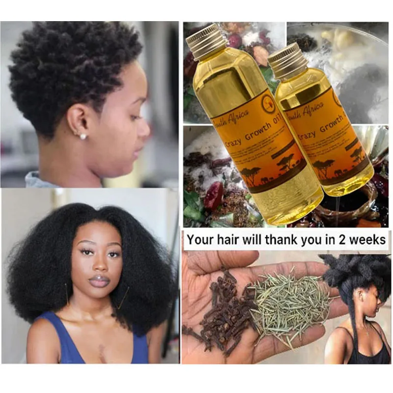 MAMA-AFRICA-Crazy-Growth-Oil-Only-10-30-ml-GROW-YOUR-HAIR-FASTER-LONGER ...