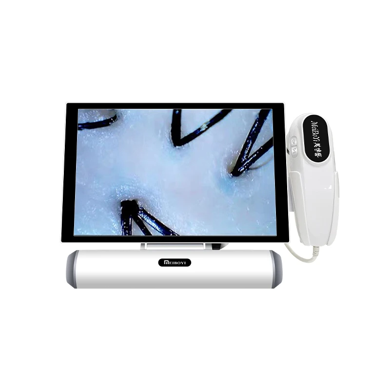 Meiboyi-Scalp-Scanner-Intelligent-Detection-Hair-And-Skin-Skin-And-Hair ...