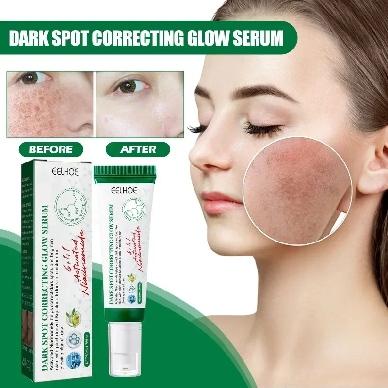 Effective-Whitening-Freckle-Essence-Remove-Dark-Spots-Anti-Melasma-Fade ...