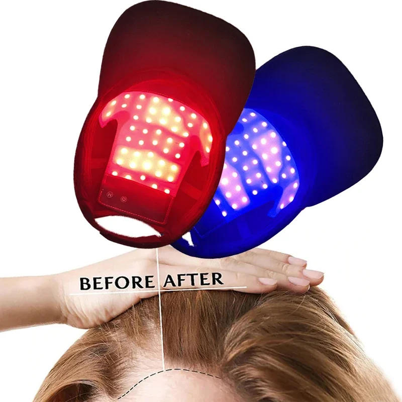 Red-Infrared-Light-Therapy-Device-Red-Light-Therapy-For-Hair-Fast ...