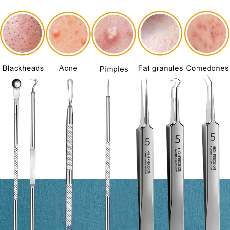 Blackheads Removal Tool