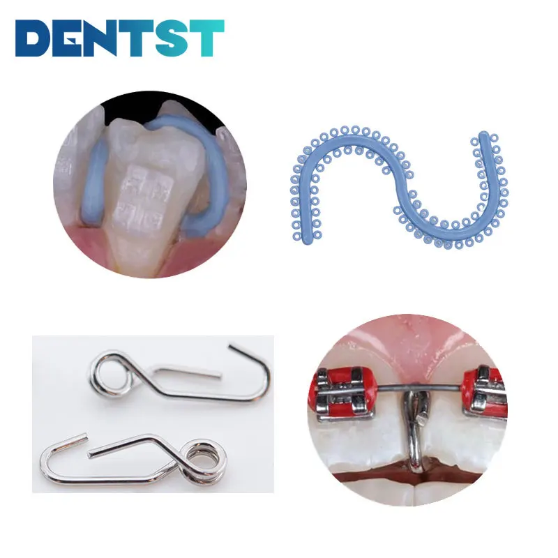Dentst-700pcs-Dental-Orthodontic-Separator-Rubber-Separator-or-10pcs ...