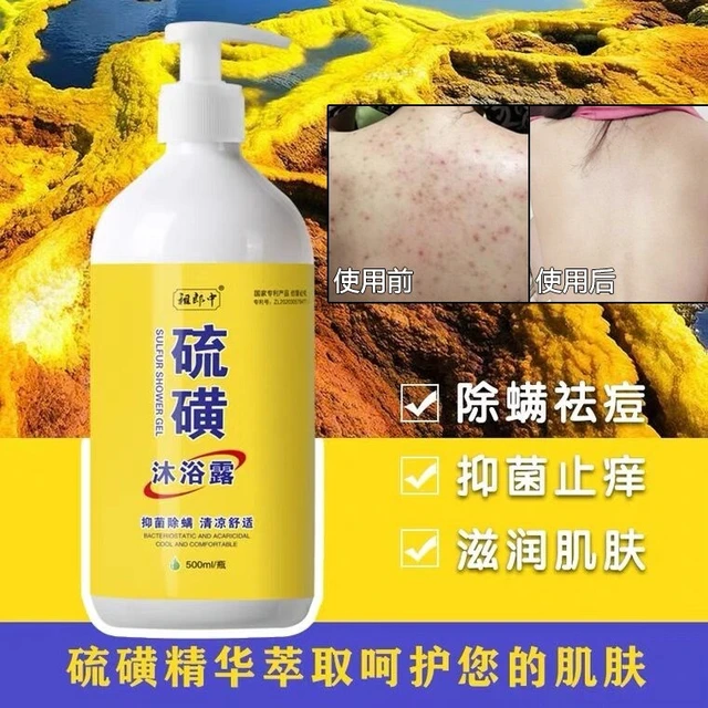 Sulfur Lotion