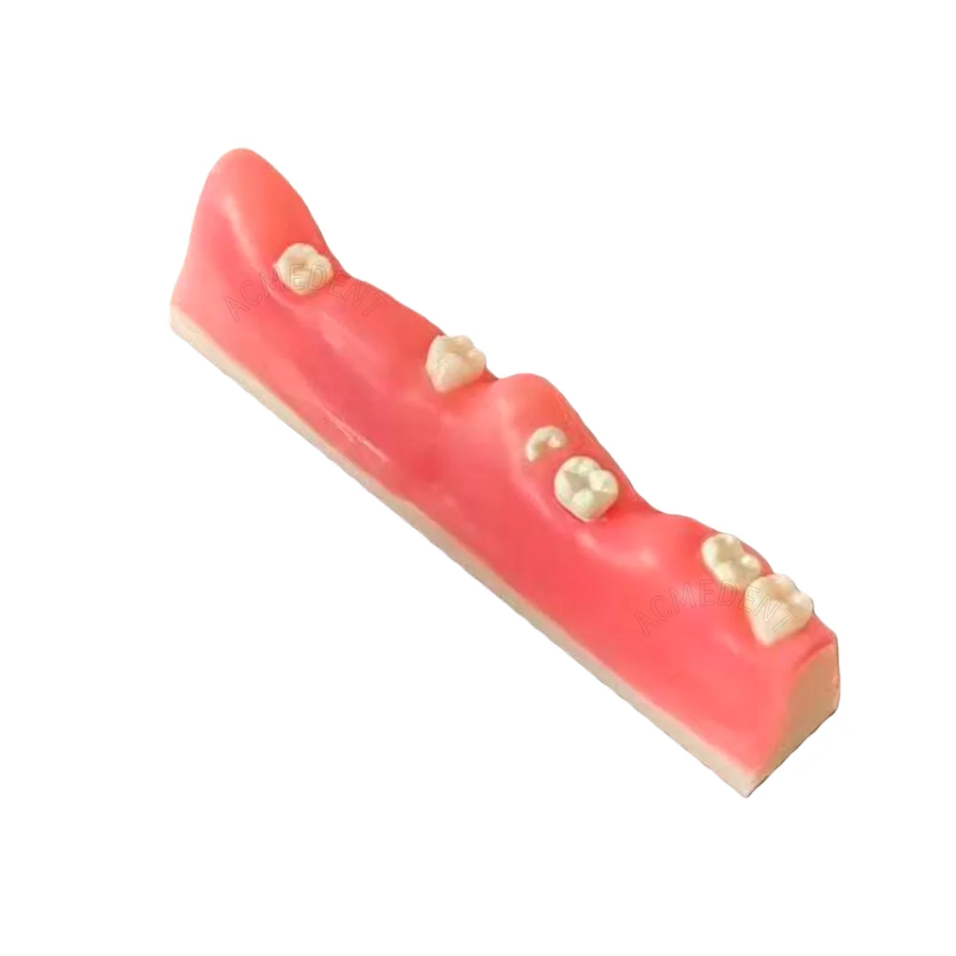 Dental Impacted Tooth Extraction Practice Model Training Extract Wisdom ...
