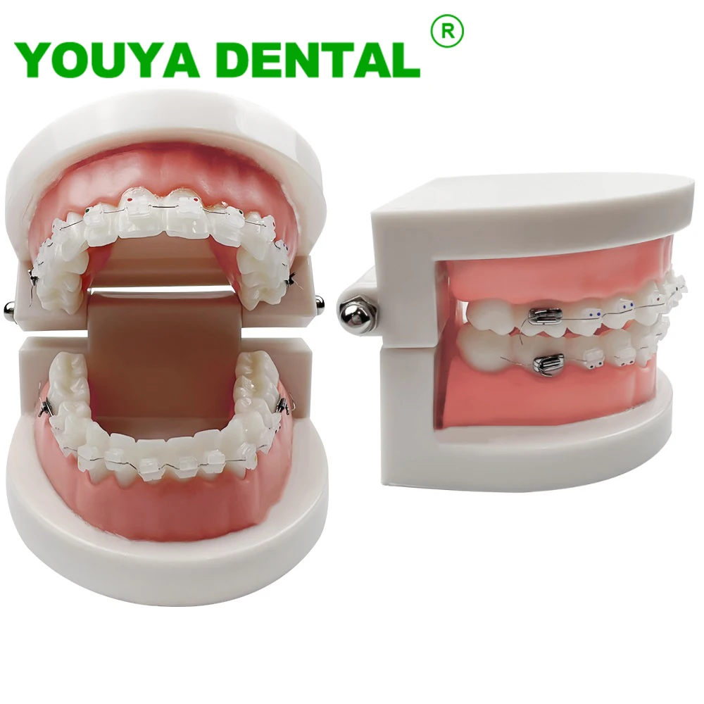 Dental Orthodontic Teeth Model With Ceramic Braces Bracket Dentistry ...