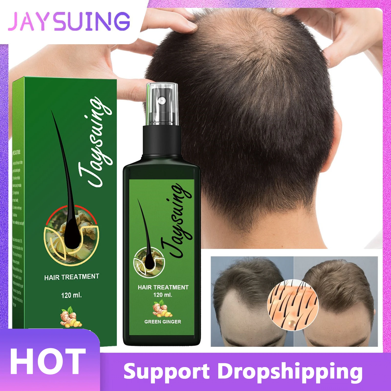 Jaysuing-Hair-Growth-Spray-Effective-Nourishing-Root-Hair-Thick-Growth-Liquid-Anti-fall-Scalp ...
