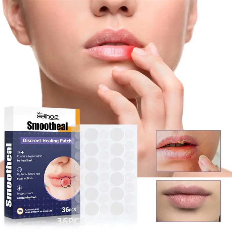 Cold Herpes Smoothing Patch Antibacterial And Anti inflammatory Herpes ...