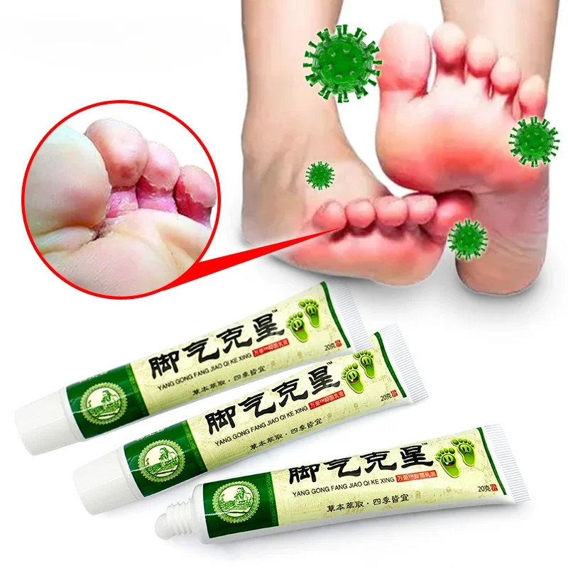 1pcs-Foot-Tinea-Pedis-Treatment-Cream-Treat-Beriberi-Ointment-Anti-itch ...