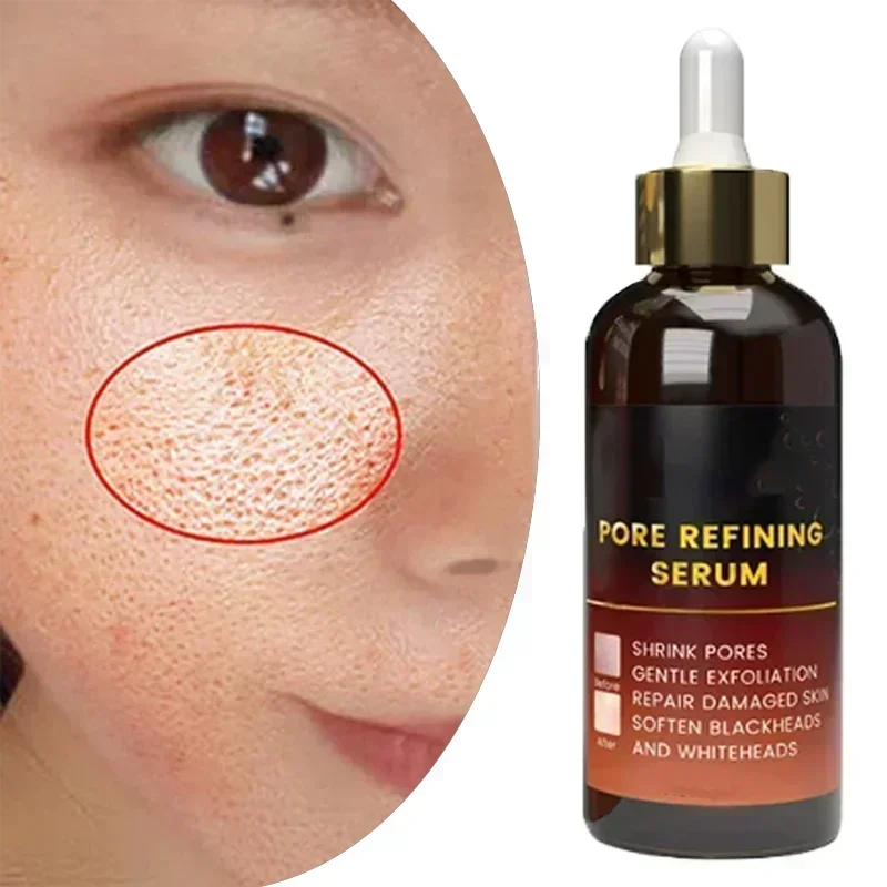 Pore-Shrink-Face-Skin-Care-Serum-Facial-Essence-For-Shrinking-Pores ...