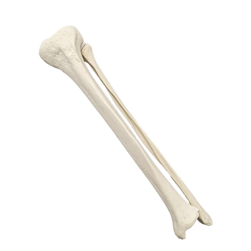 Human Tibia Fibula