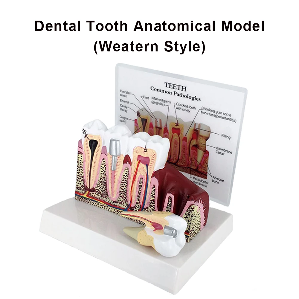 Dental-Anatomical-Model-Tooth-Western-Style-Teaching-Demonstration ...