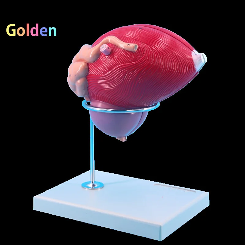 Human-Bladder-Amplification-Model-Medical-Special-Magnification-3-Times ...