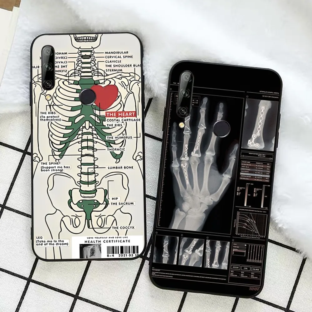 Radiological-human-organs-Skeleton-skull-Phone-Case-For-Huawei-Honor-10 ...