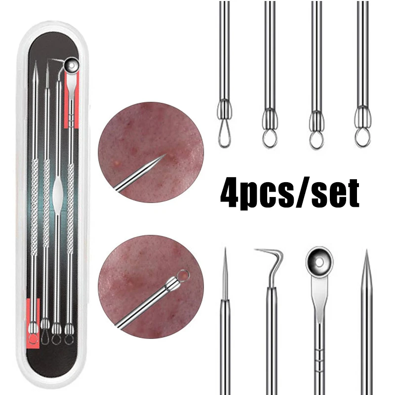 4pcs/set Blackhead Acne Remover Tool Stainless Steel Acne Extractor ...