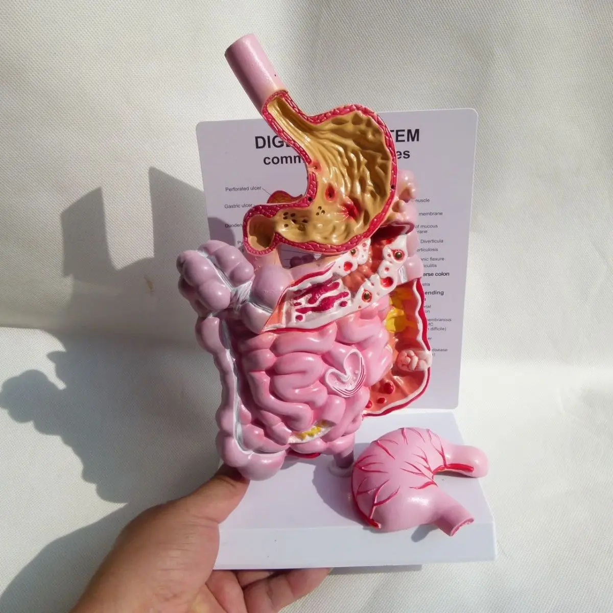 Anatomical-model-of-human-digestive-system-model-of-large-intestine ...