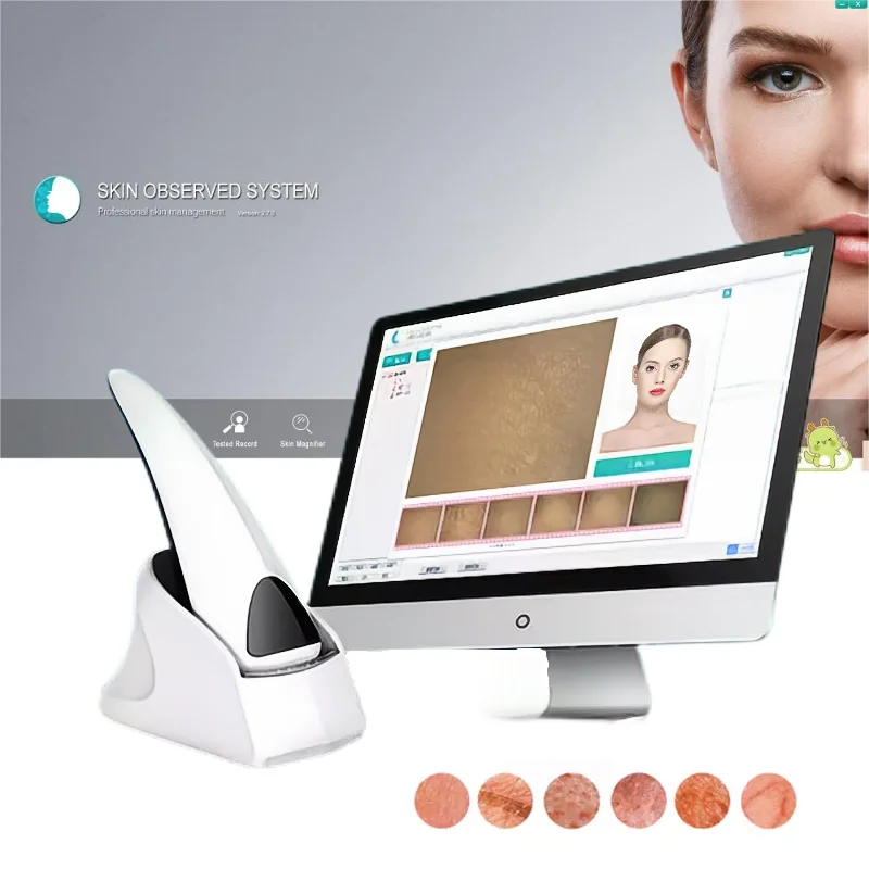Professional Facial Skin Detector Moisture Pores Tester Wrinkles Aging ...
