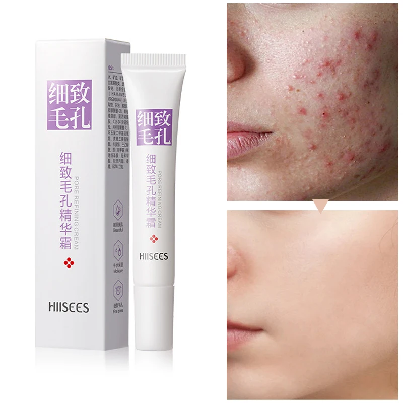 cido-Salic-lico-Poro-Shrinking-Cream-Elimina-o-R-pida-Poros-Grandes ...