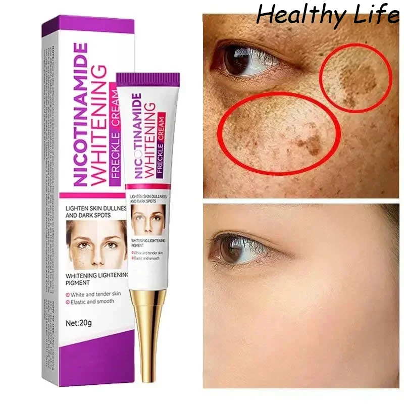 Mild-Niacinamide-Lightening-Melasma-Cream-Effectively-Fade-Melanin ...