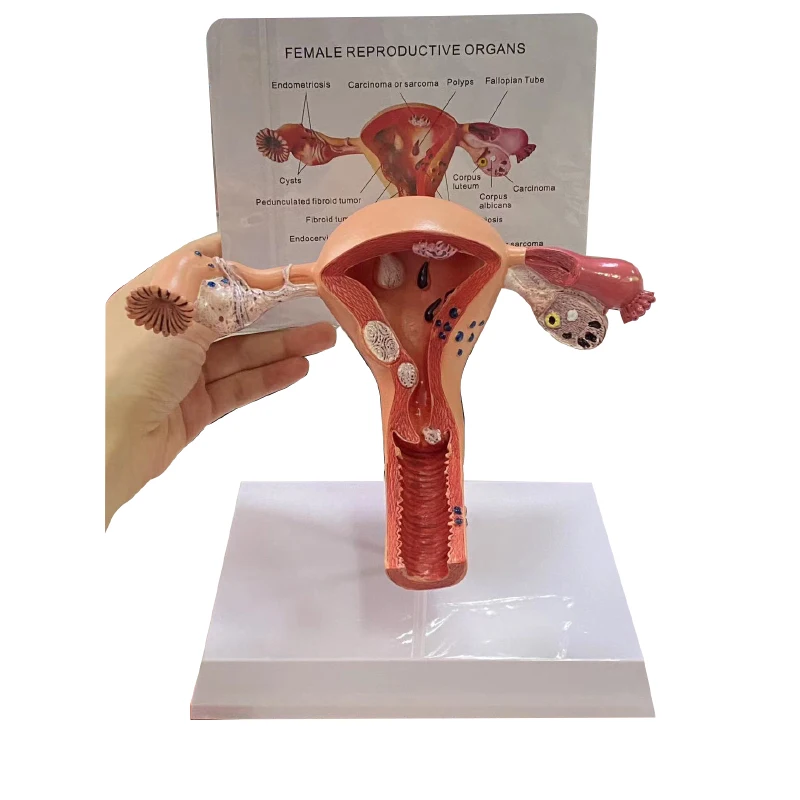 Ovary Model Anatomy