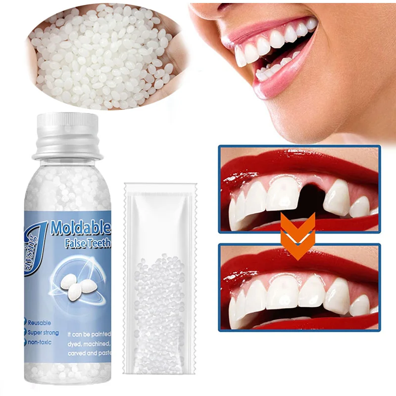 Temporary-Resin-Tooth-Repair-Glue-Shapeable-Falseteeth-Gaps-Filling ...