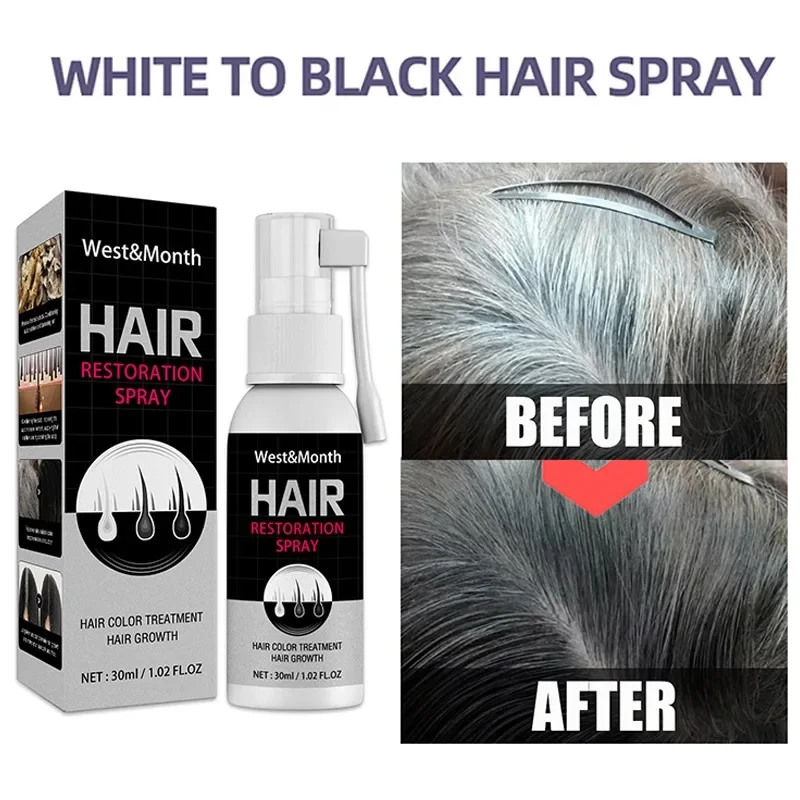 Grey-Hair-Treatment-Serum-Anti-Hair-Loss-Hair-Growth-Spray-Anti ...