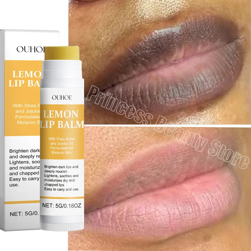 Remove-Dark-Lip-Balm-Lightening-Melanin-Mask-Gloss-Oil-Exfoliating ...