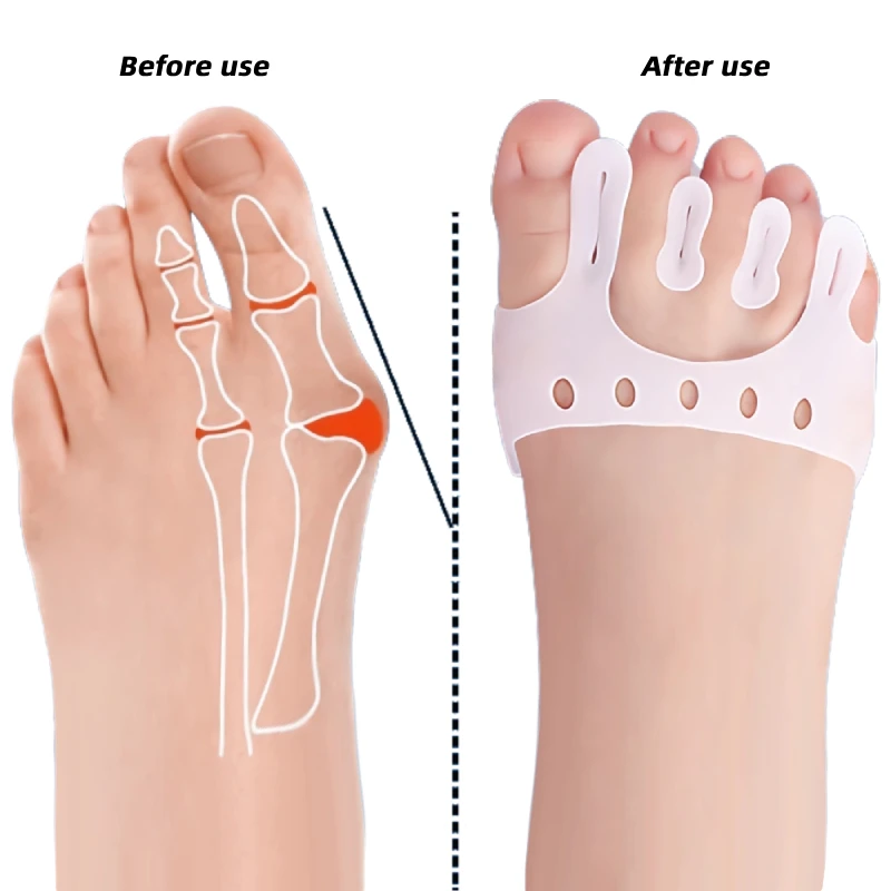 6pieces-3pairs-Toe-Splitter-Separator-Silicone-Metatarsal-Cushion-Gel ...