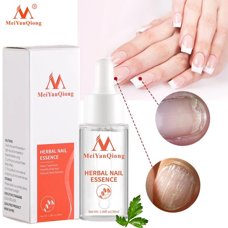 Nail Fungal Treatment Feet Care Essence Nail Foot Whitening Toe Nail ...