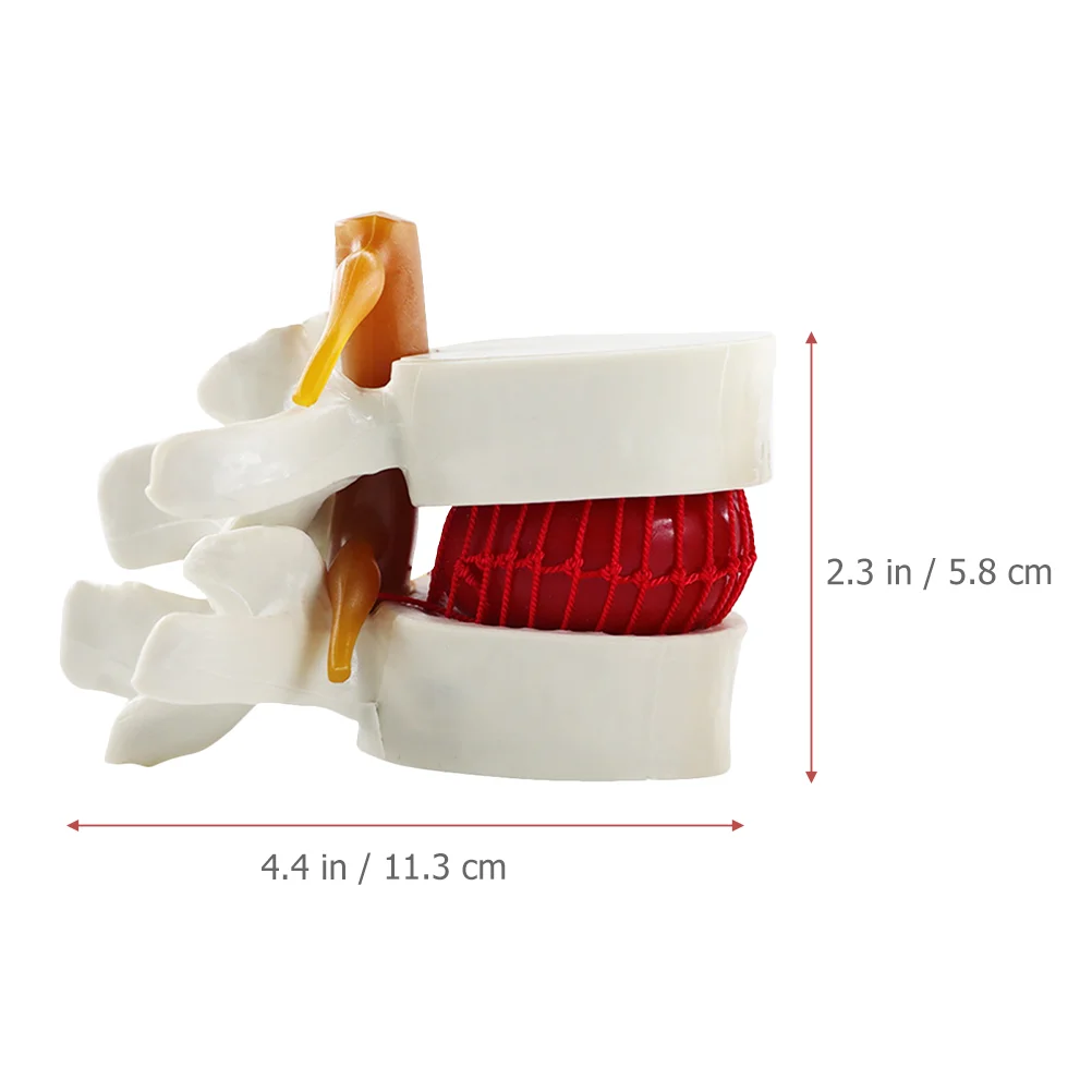Model Spine Lumbar Herniation Disc Human Models Anatomical Vertebrae ...
