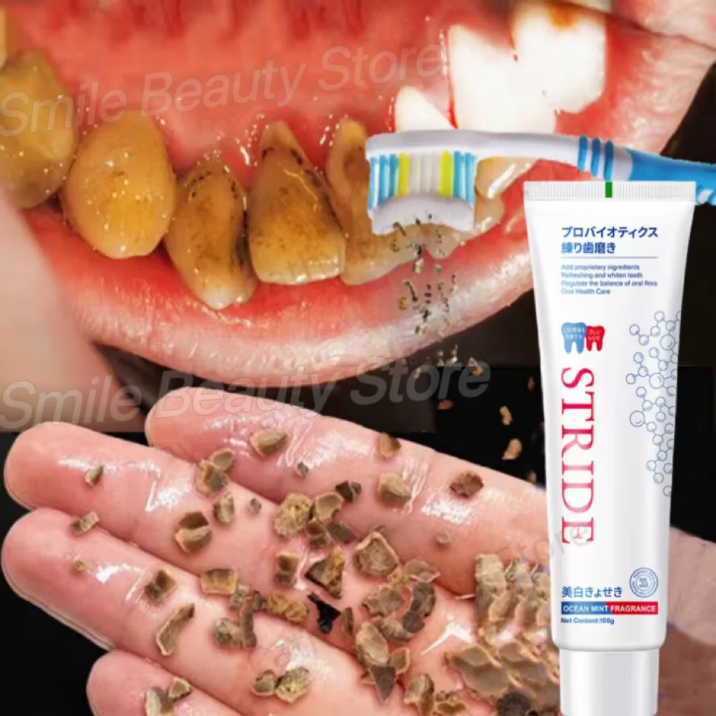 Dental-Calculus-Remover-Teeth-Whitening-Toothpaste-Remove-Plaque-Stains ...