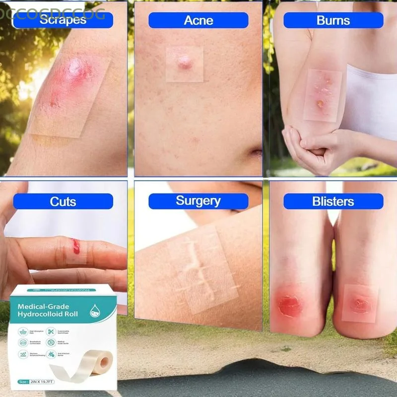 "Durable Hydrocolloid Band Aid Roll for Comprehensive Wound Care, Extra ...