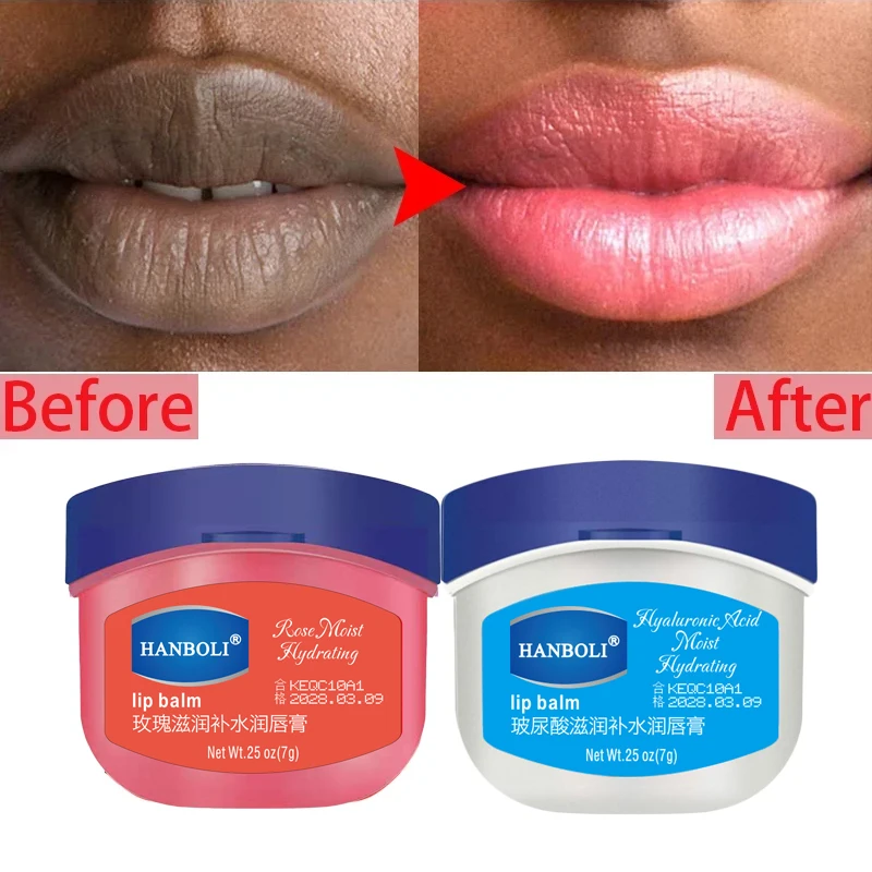 Remove-Dark-Lip-Balm-Lightening-Melanin-Mask-Gloss-Oil-Exfoliating ...