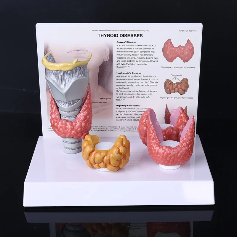 Human Anatomical Thyroid Gland Model Pathology Anatomy Digestive System Display Study Teaching ...