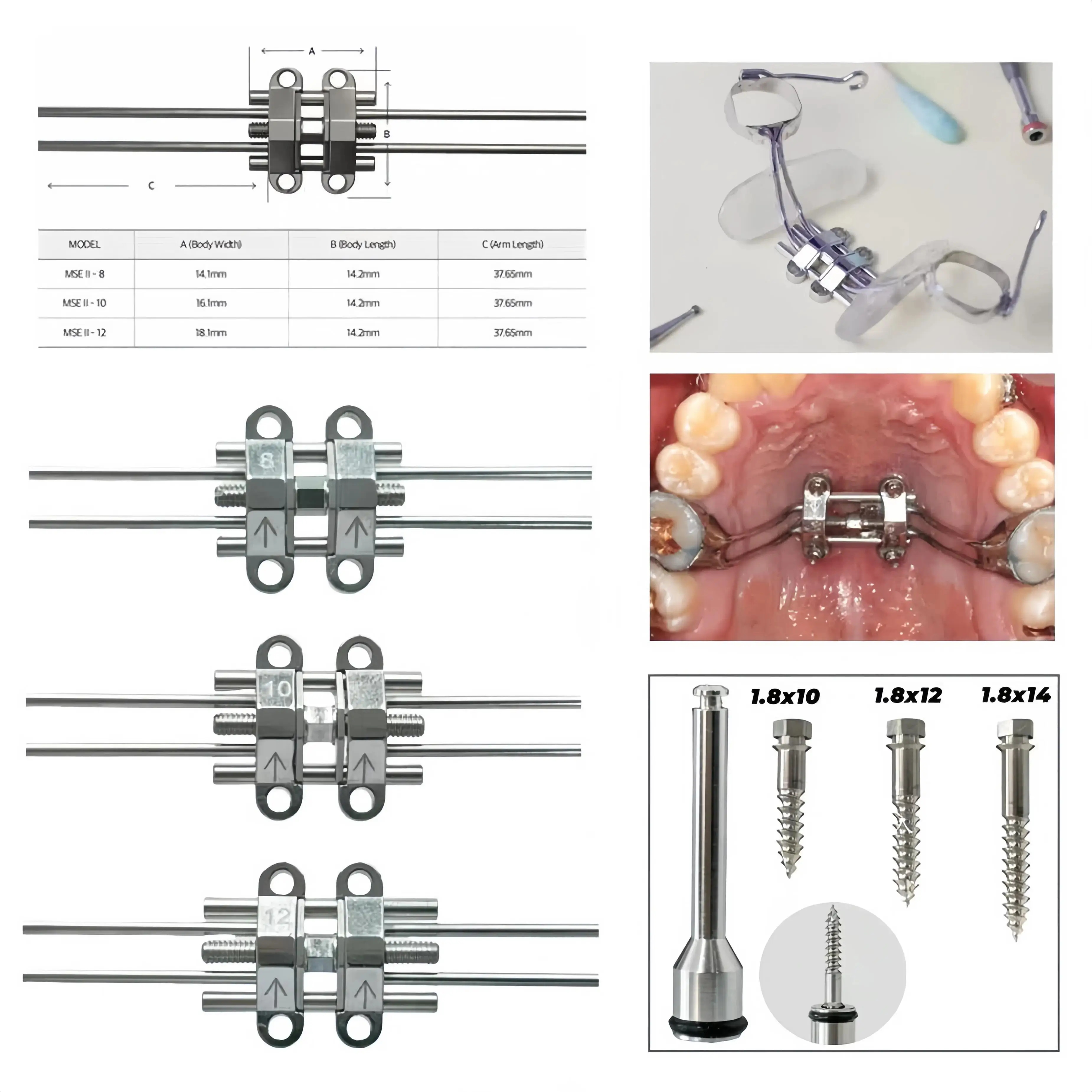 MSE Expansion Explained: How the MSE-II Device Transformed My Adult ...