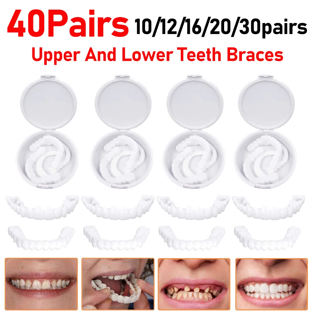 40-10Pairs-Smile-Whitening-Teeth-Snap-Cap-Regain-Confident-Smile-Upper ...