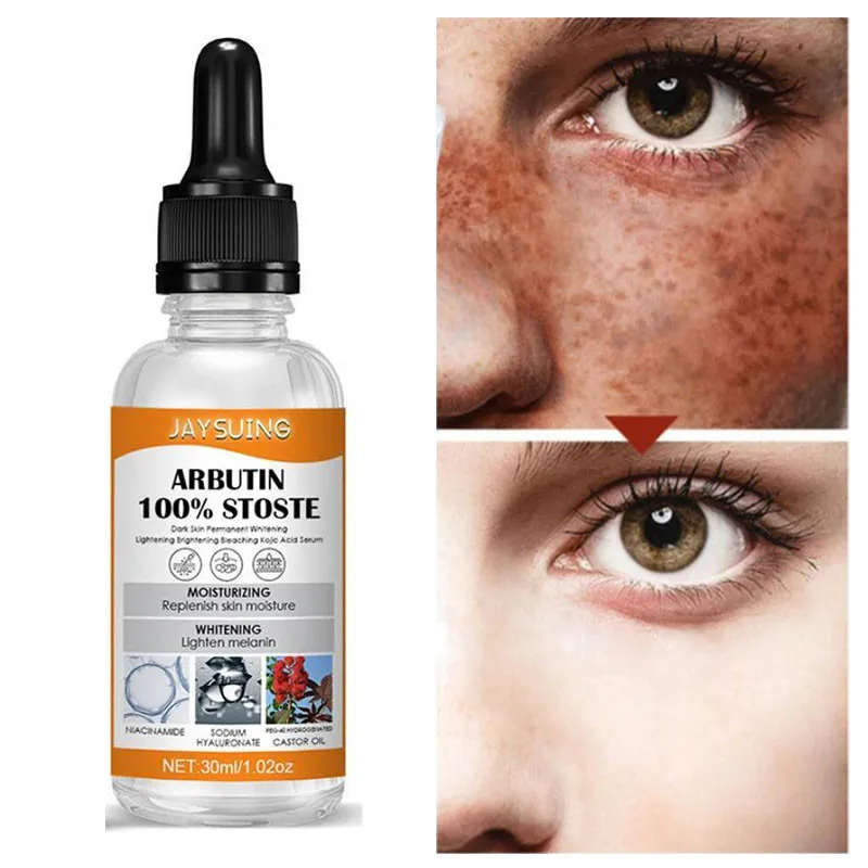 Arbutin Whitening Freckle Face Serum Body Underarm Bleaching Reduce ...