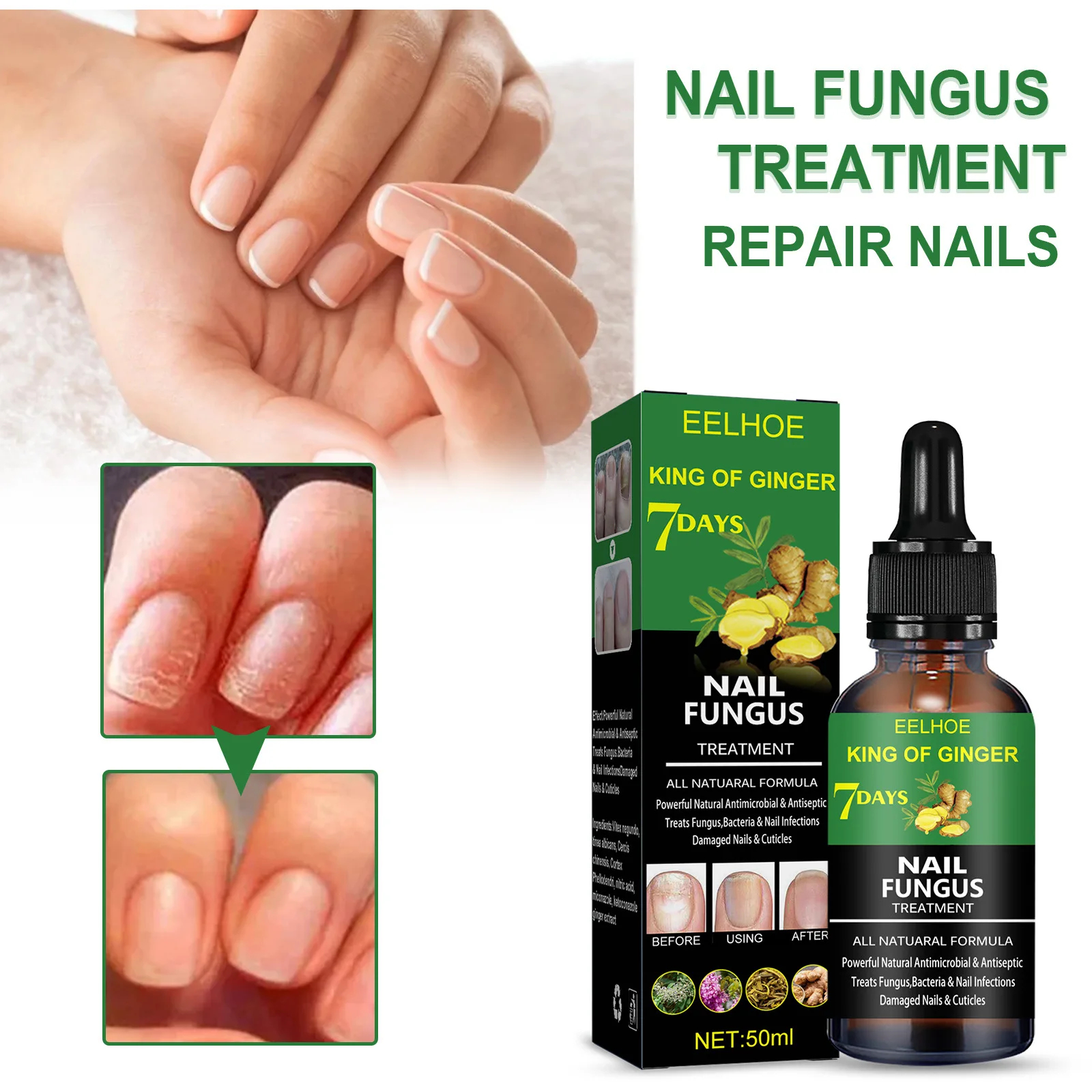 Nail Care Antiseptic Solution