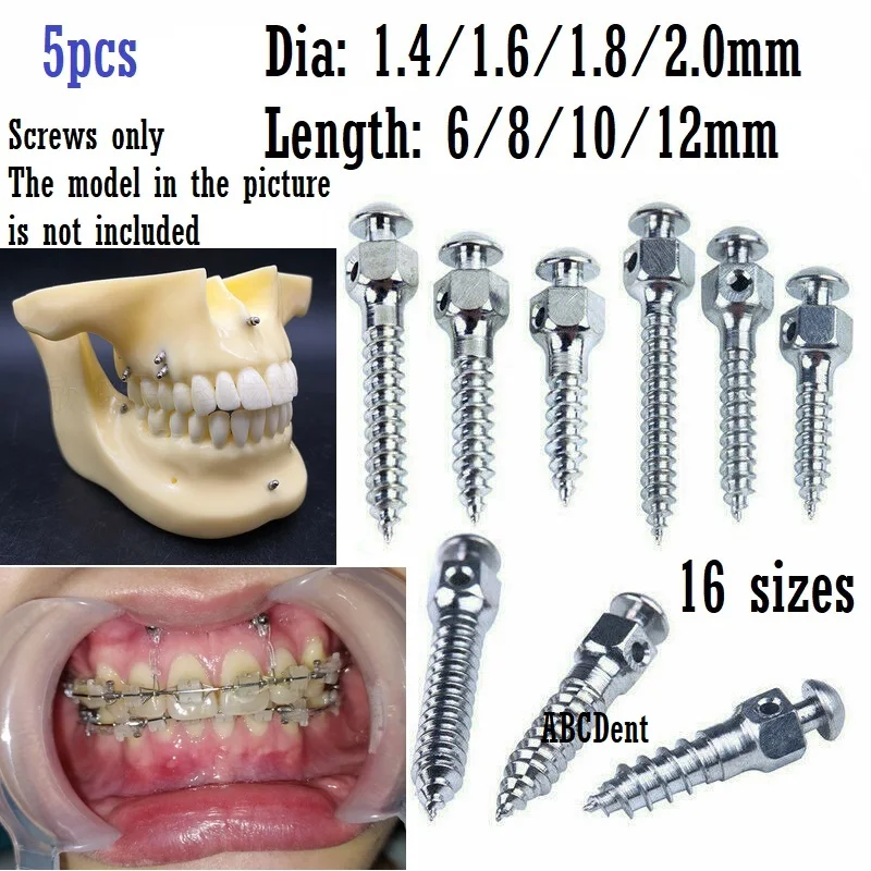 5pcs-Mini-Implant-Dental-Orthodontic-Micro-Screw-Self-Taping-Spring ...