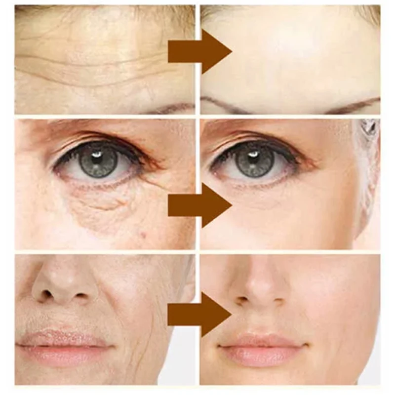Prevent Skin Aging Moisturizing Improves Skin Elasticity Lift And Firm ...
