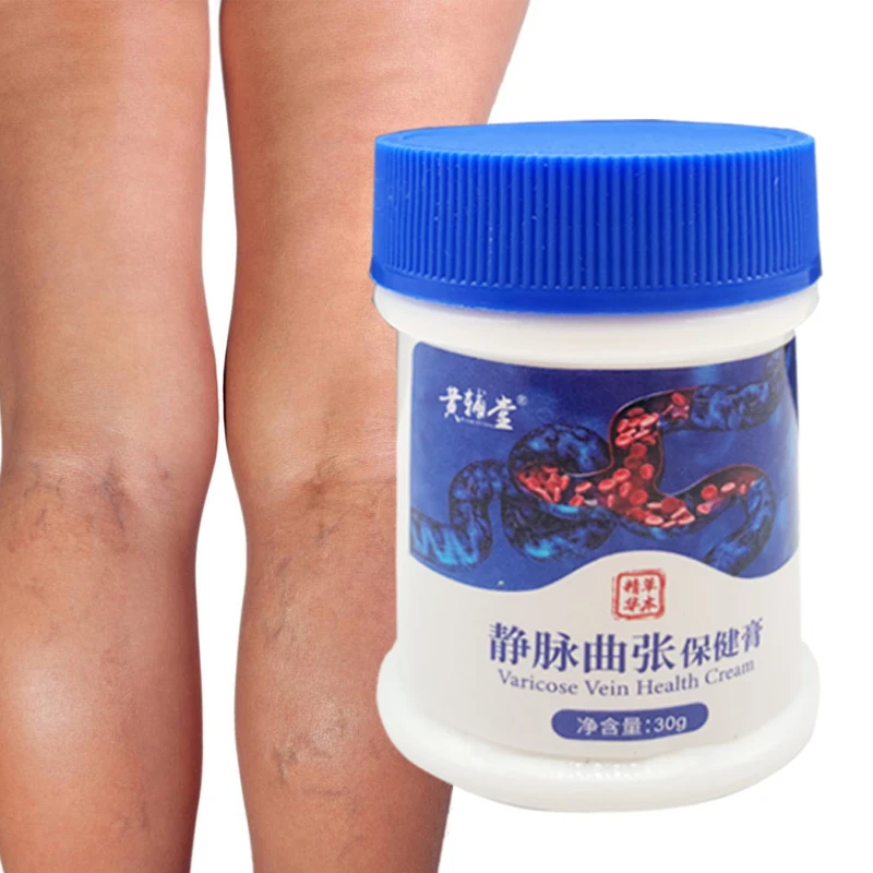 30g-ZB-Varicose-Veins-Treatment-Vasculitis-Phlebitis-Spider-Cream ...
