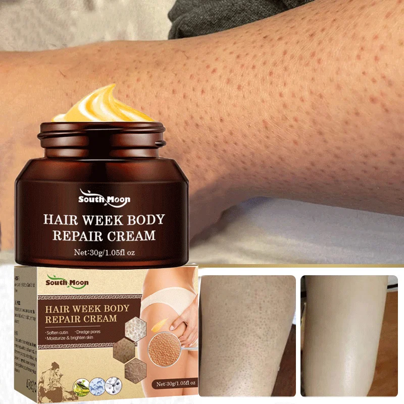Curing-Keratosis-Pilaris-Repair-Cream-Chicken-Follicle-Skin-Body-Scrub ...