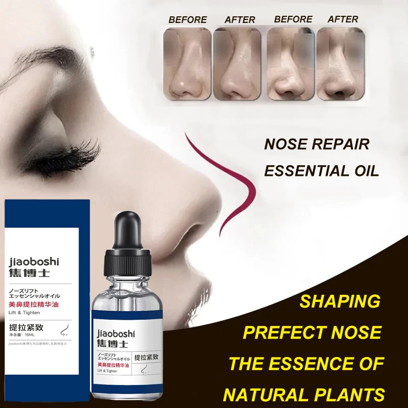 Nose-Up-Heighten-Rhinoplasty-oil-Nose-Up-Heighten-Rhinoplasty-Nasal ...