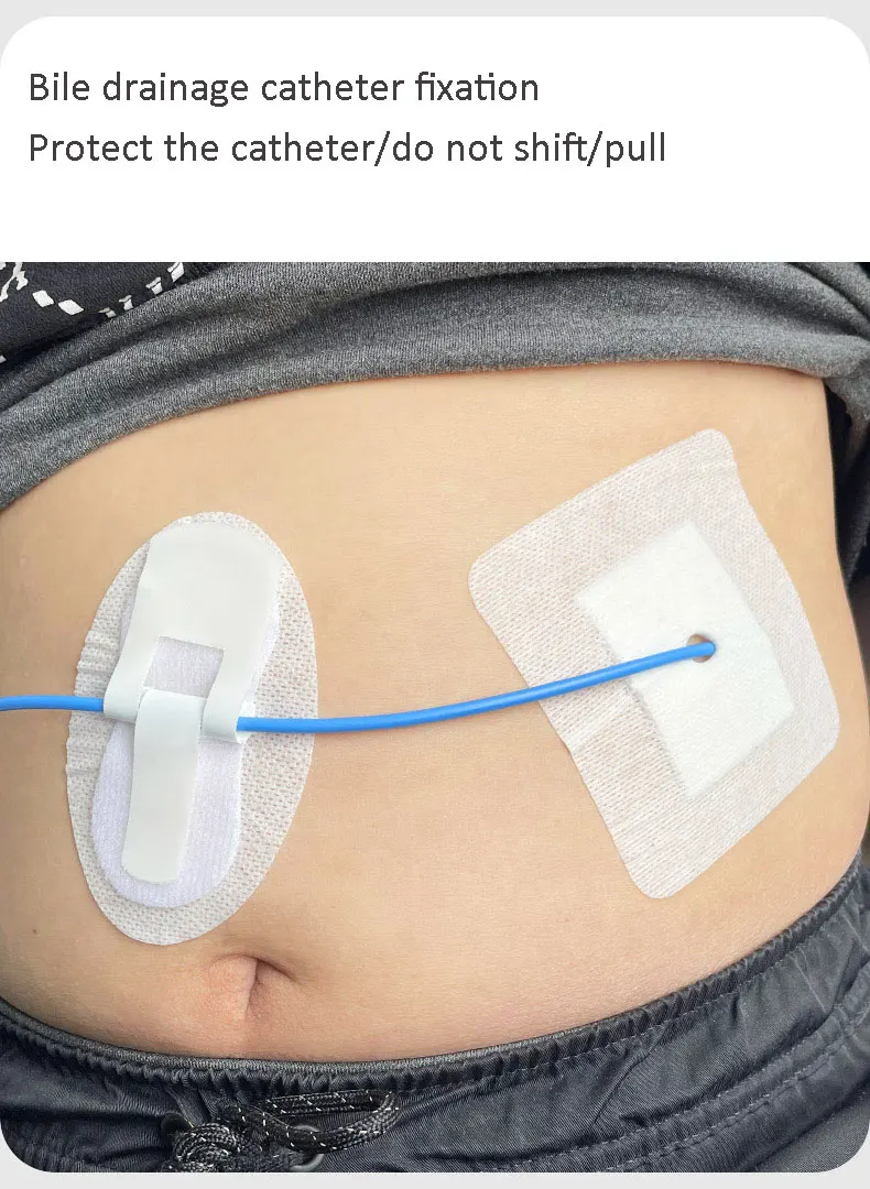 Drainage-Tube-Sterile-Applicator-Peritoneal-Dialysis-Catheter-Bile-Duct ...