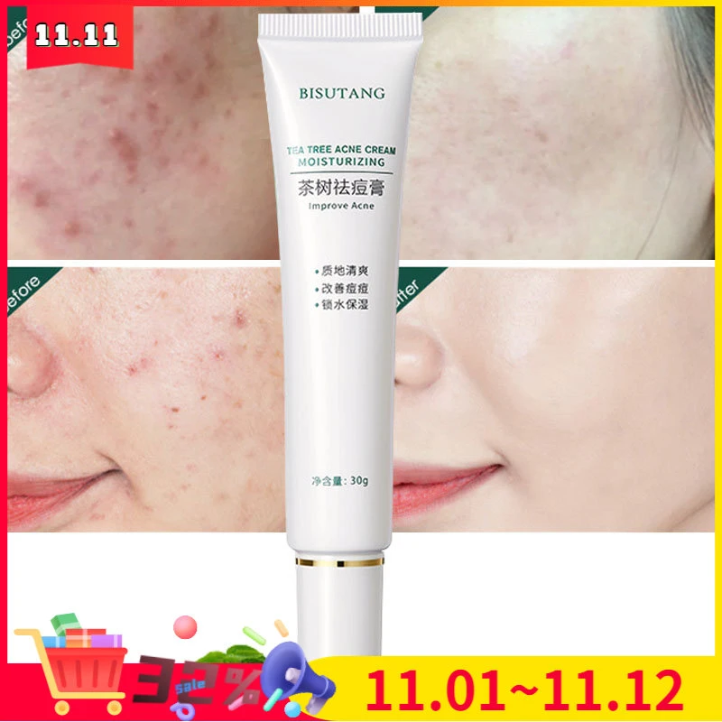 Herbal Acne Removal Face Cream Oil Control Anti-acne Gel Treatment Mark Skin Care Whitening ...