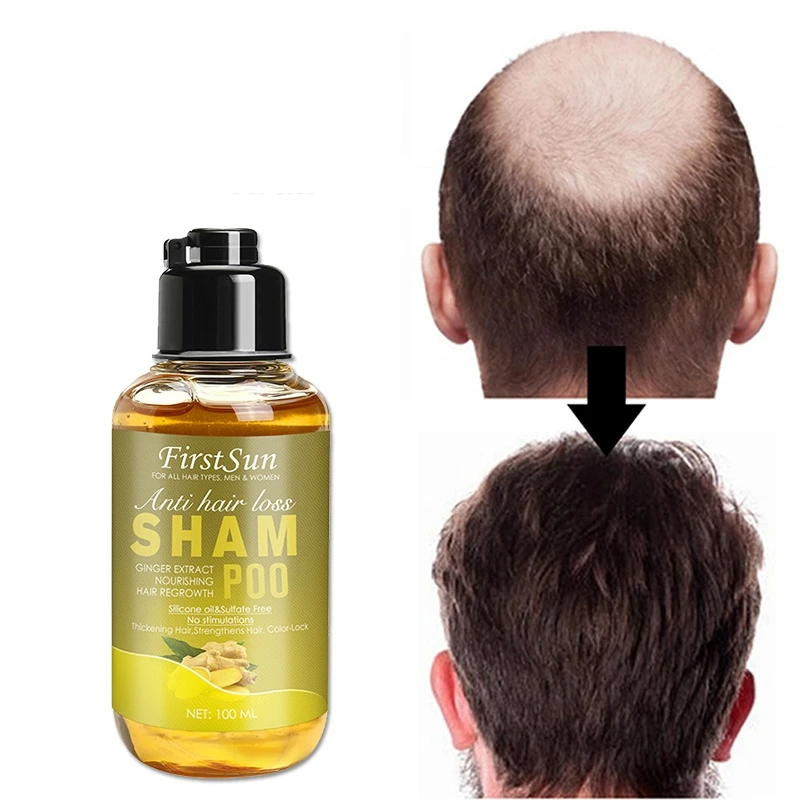 Firstsun-Professional-Hair-Ginger-Shampoo-Hair-Regrowth-Fast-Thicker ...