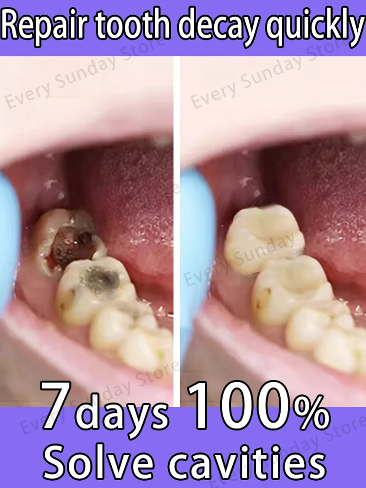 Clean-cavities-whiten-teeth-remove-plaque-treat-periodontitis-freshen ...