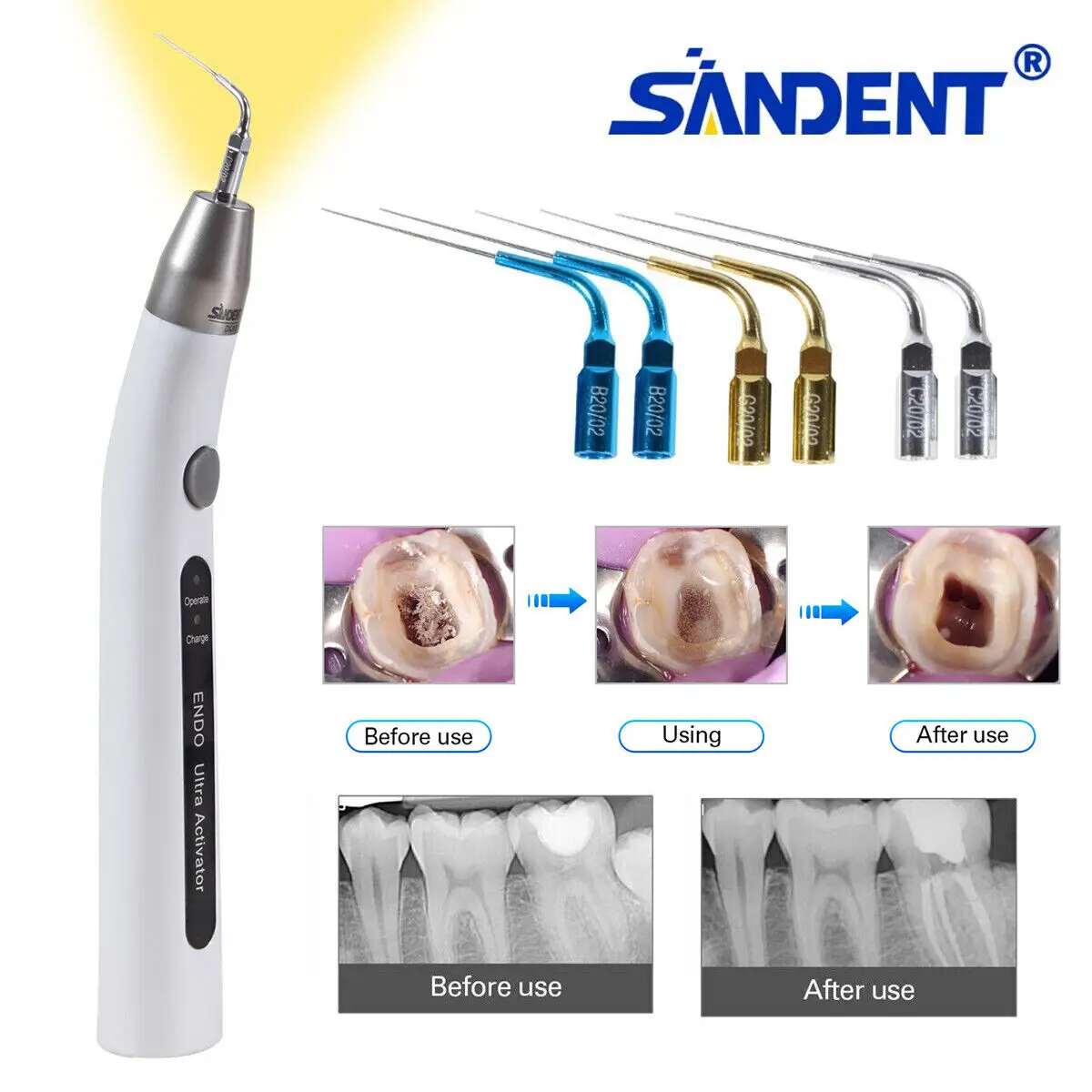 Irrigador-ultras-nico-LED-endodoncia-Dental-Ultra-Activadora-Canal-radicular-pieza-de-mano-con-6 ...