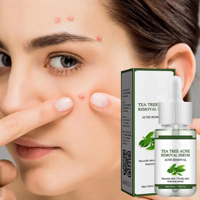 Tea Tree Acne Removal Serum Pore Shrinking Essence Pimple Repair ...