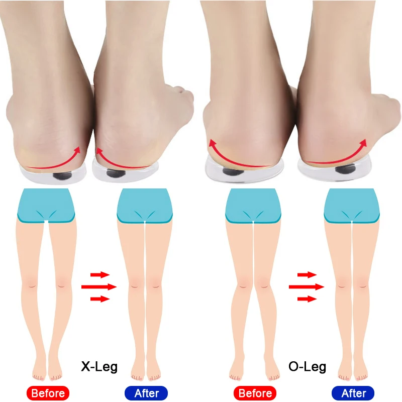 Magnets Silicon Orthopedic Insoles Foot Care Tool For Men Women Health ...